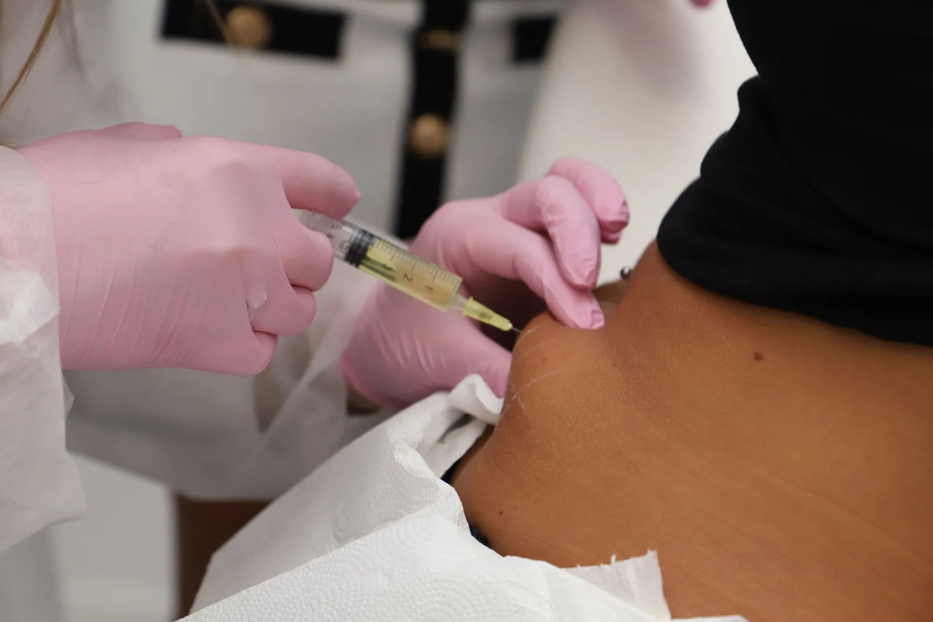 Lipoliza iniekcyjna - opis, efekty, zalecenia - K-Esthetic